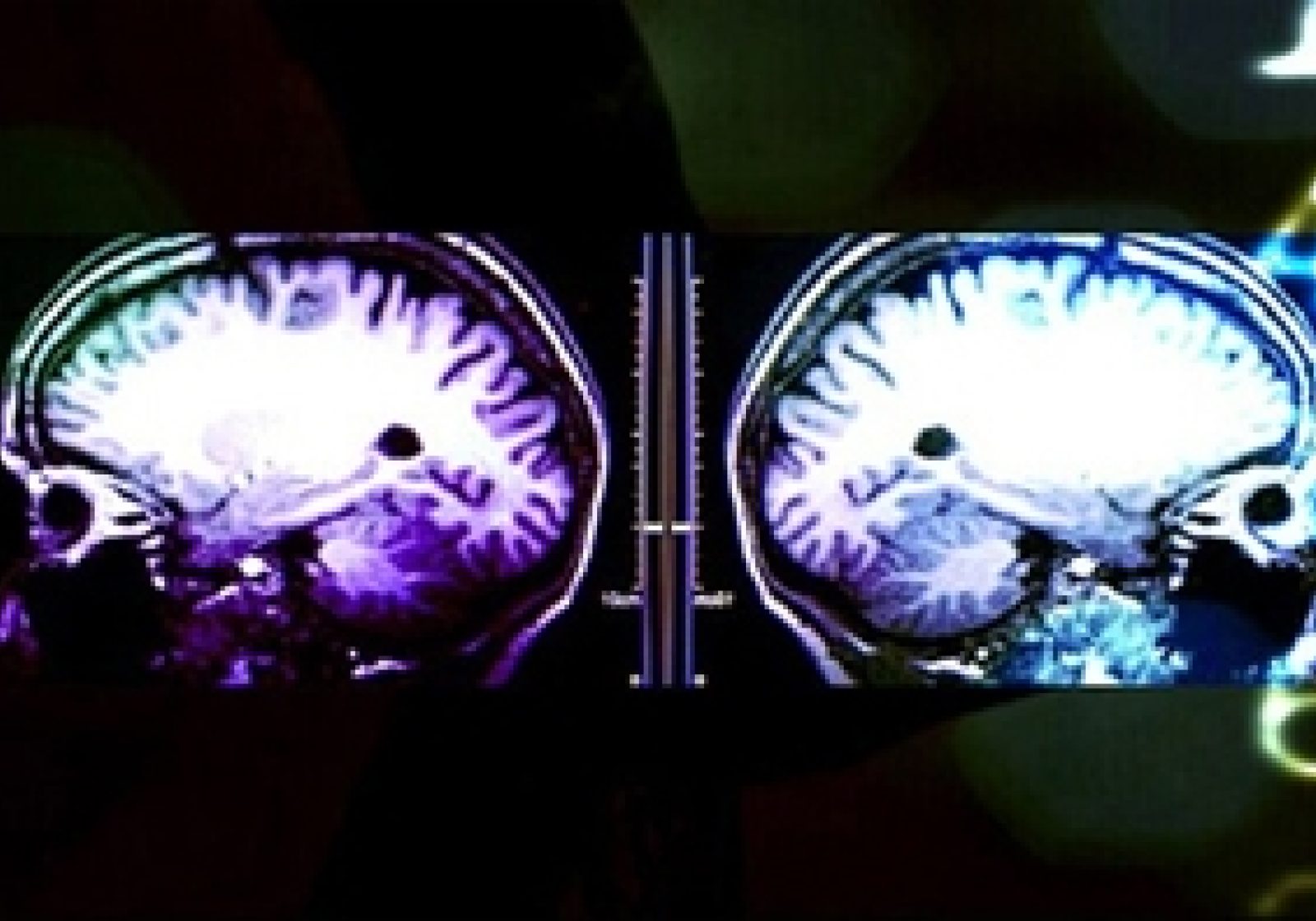 Policy Innovations Digital Magazine (2006-2016): Briefings: Brain Scan ...